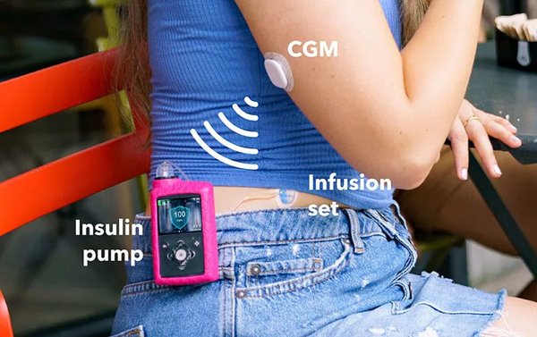 Continuous Glucose Monitors (CGM) | MiniMed